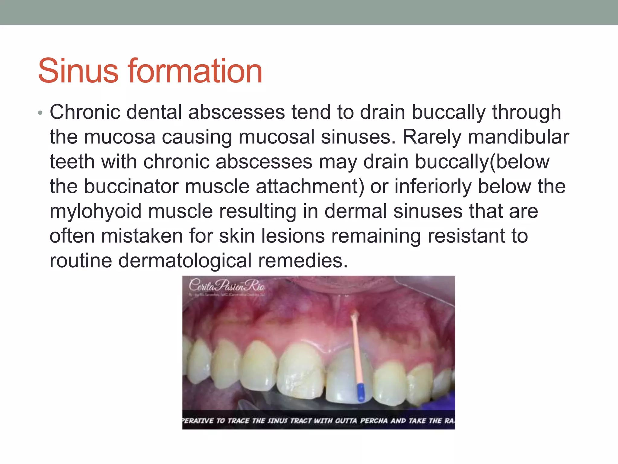 Assessment and diagnosis of pain in dental practice | PPTX