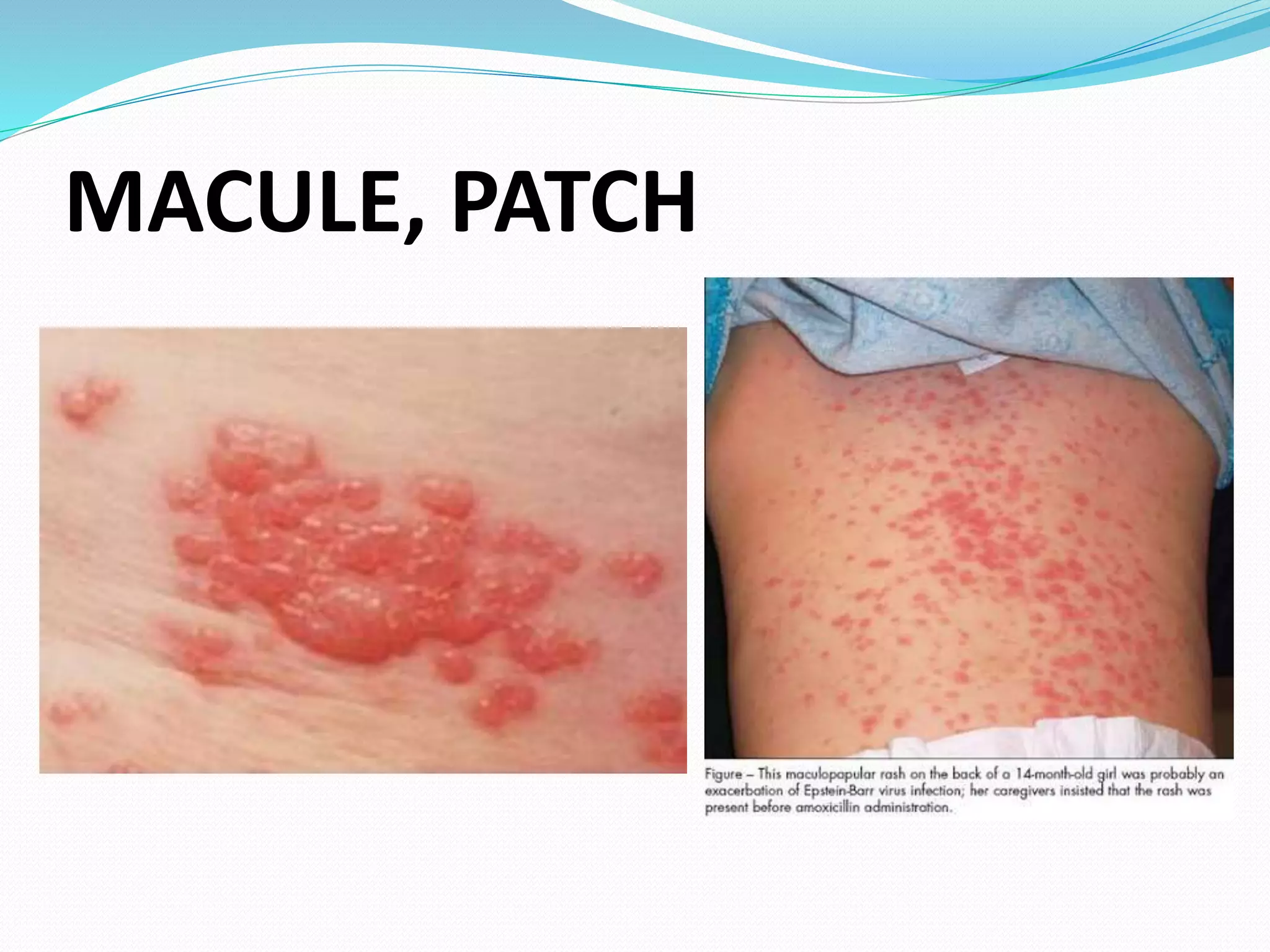 Assessment and diagnostic evaluation of integumentary system | PPTX