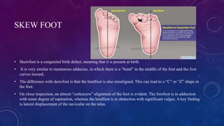 Assessment and evaluation tools for pediatric and acquired congenital ...