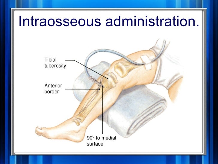 Assessment And Managment Of Critically Ill Child 1