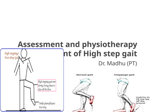 Assessment and physiotherapy management of High step gait.pptx ...