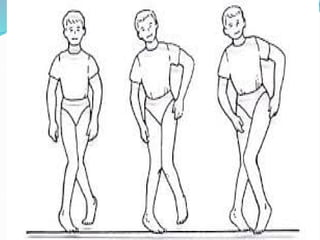 Assessment and physiotherapy management of Scissoring Gait.pptx