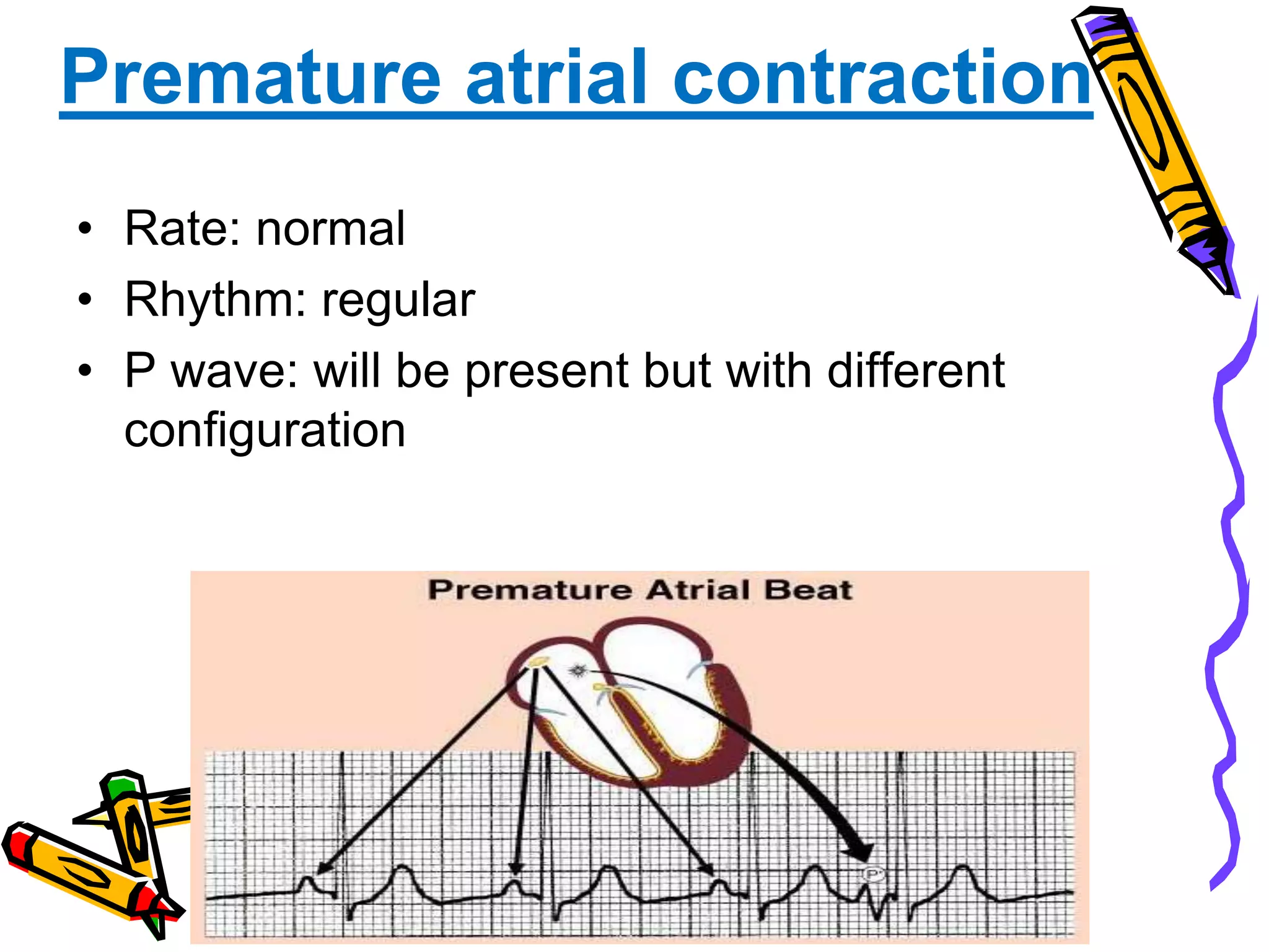 Assessment and risk stratification for cardiac rehabilitation | PPTX