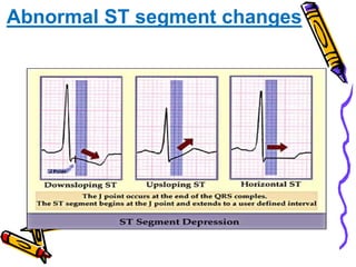 Assessment and risk stratification for cardiac rehabilitation | PPTX