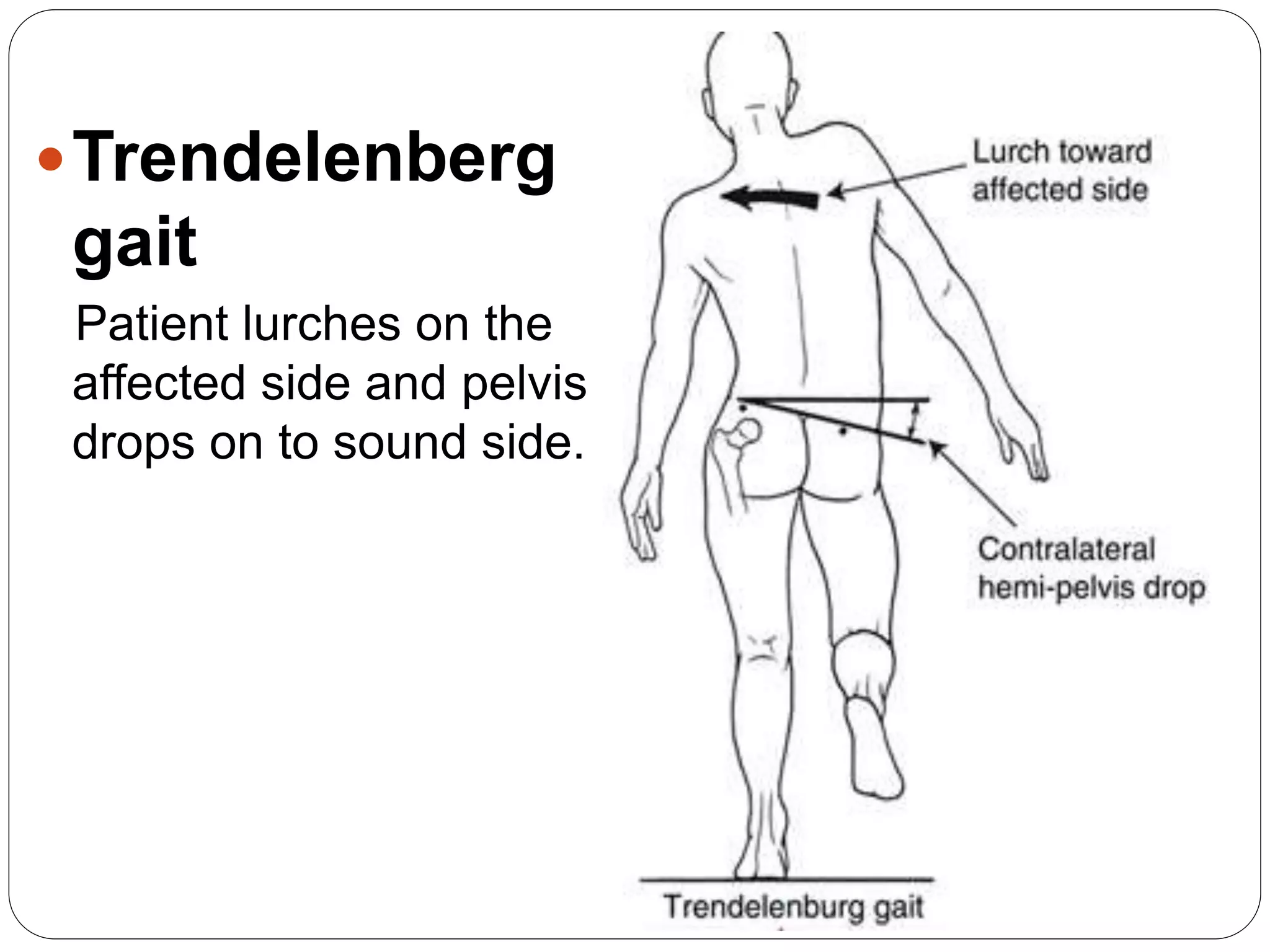 Assessment and special tests of Hip joint | PPTX