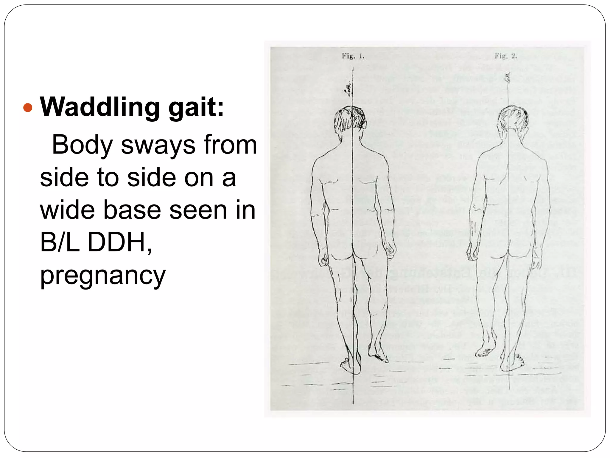 Assessment and special tests of Hip joint | PPTX