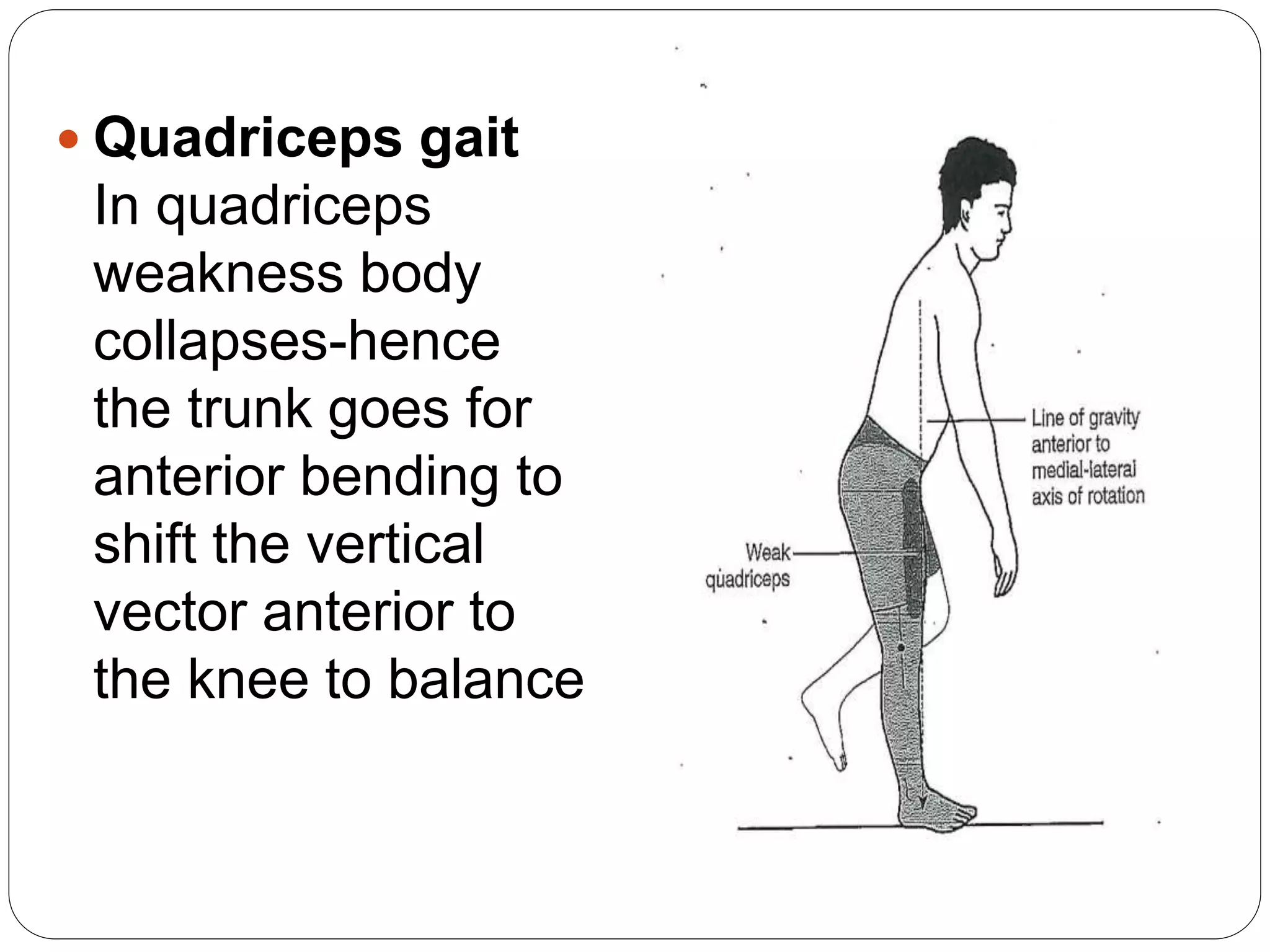 Assessment and special tests of Hip joint | PPTX