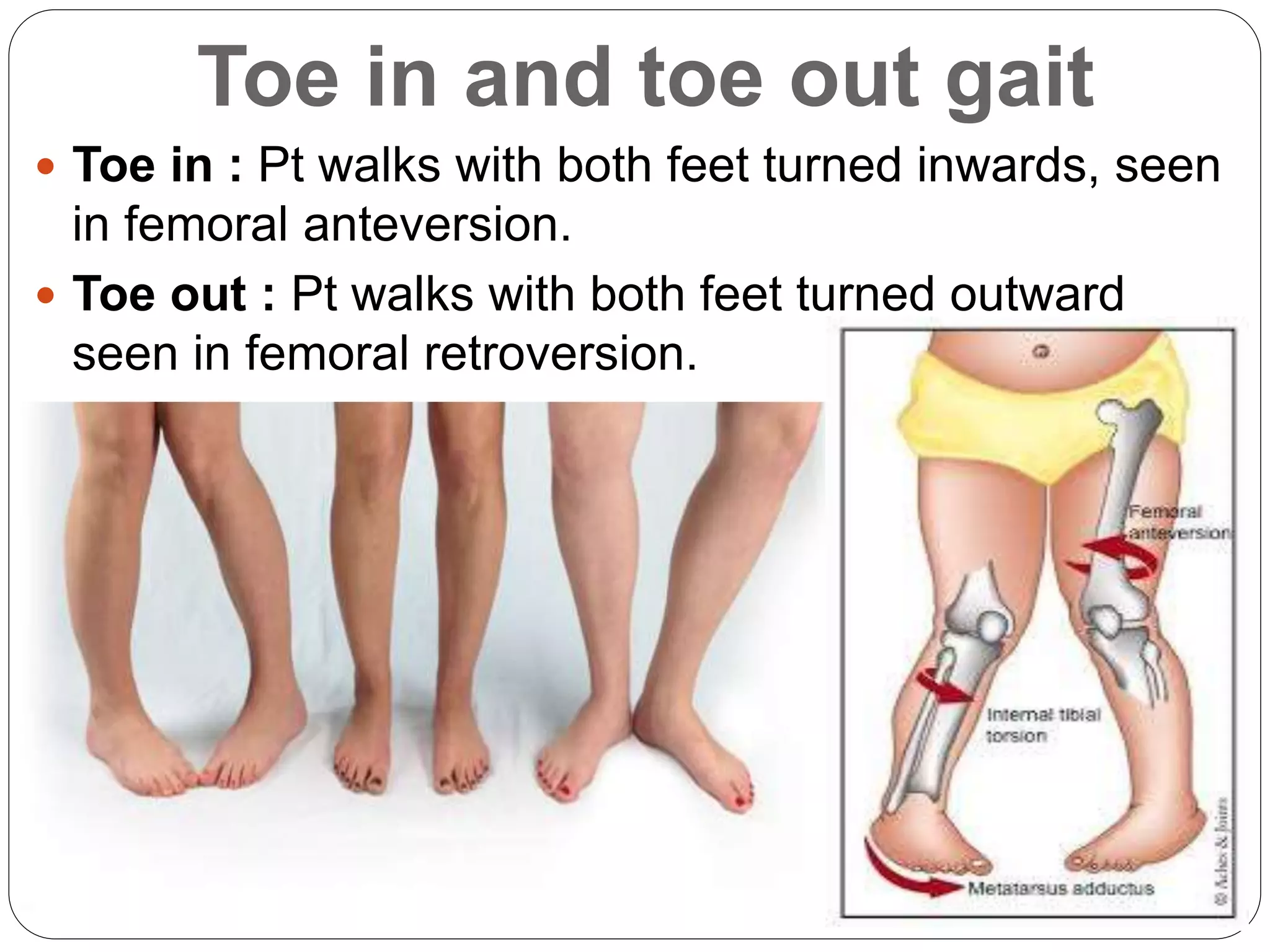 Assessment and special tests of Hip joint | PPTX