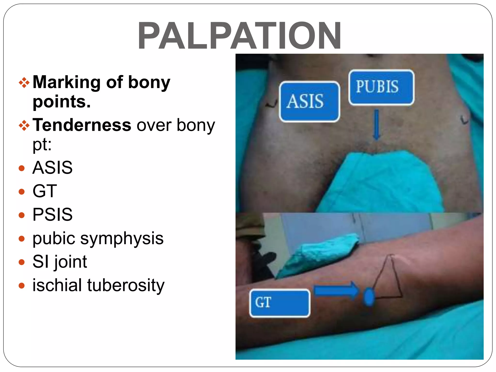 Assessment and special tests of Hip joint | PPTX