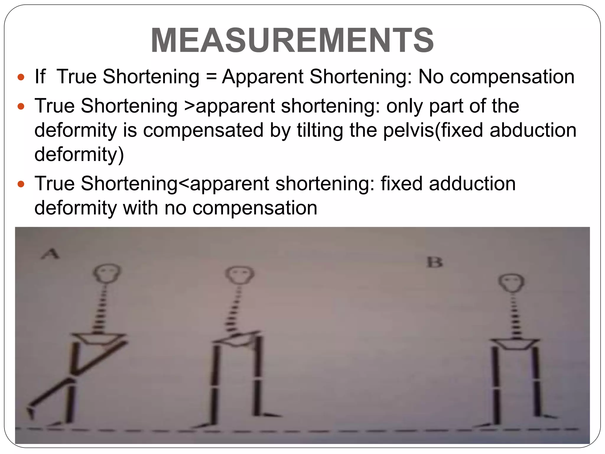 Assessment and special tests of Hip joint | PPTX
