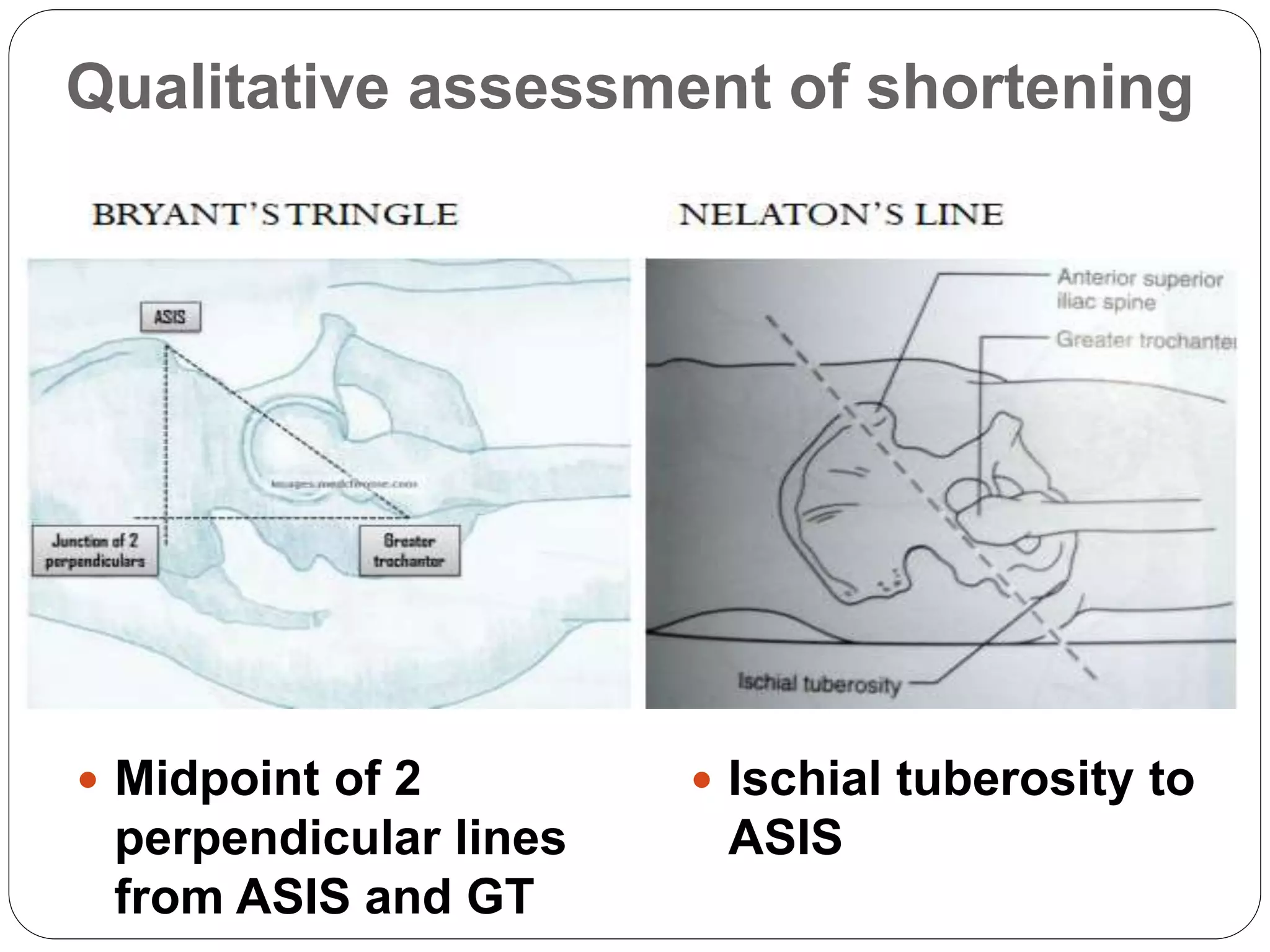 Assessment and special tests of Hip joint | PPTX