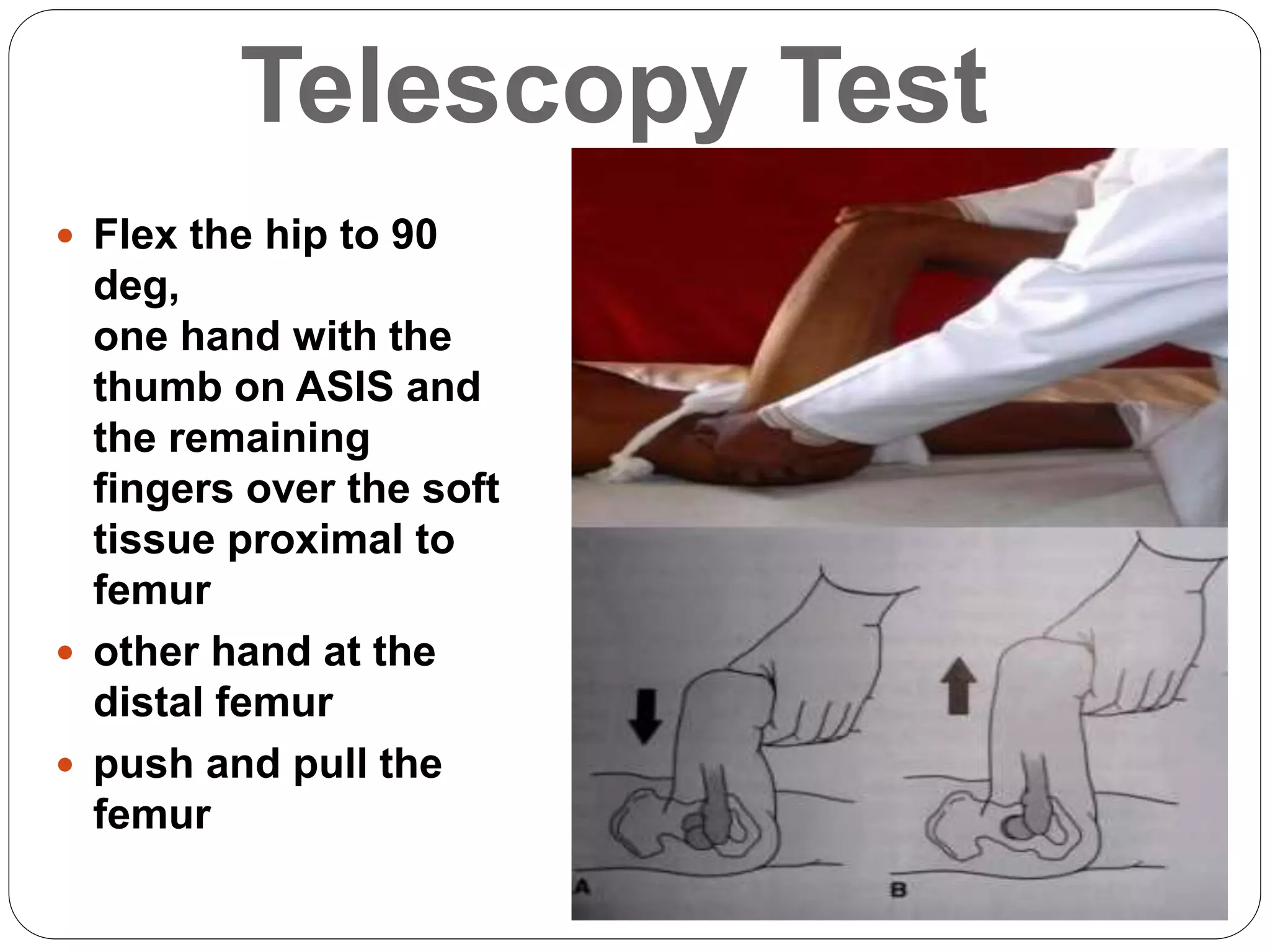 Assessment and special tests of Hip joint | PPTX