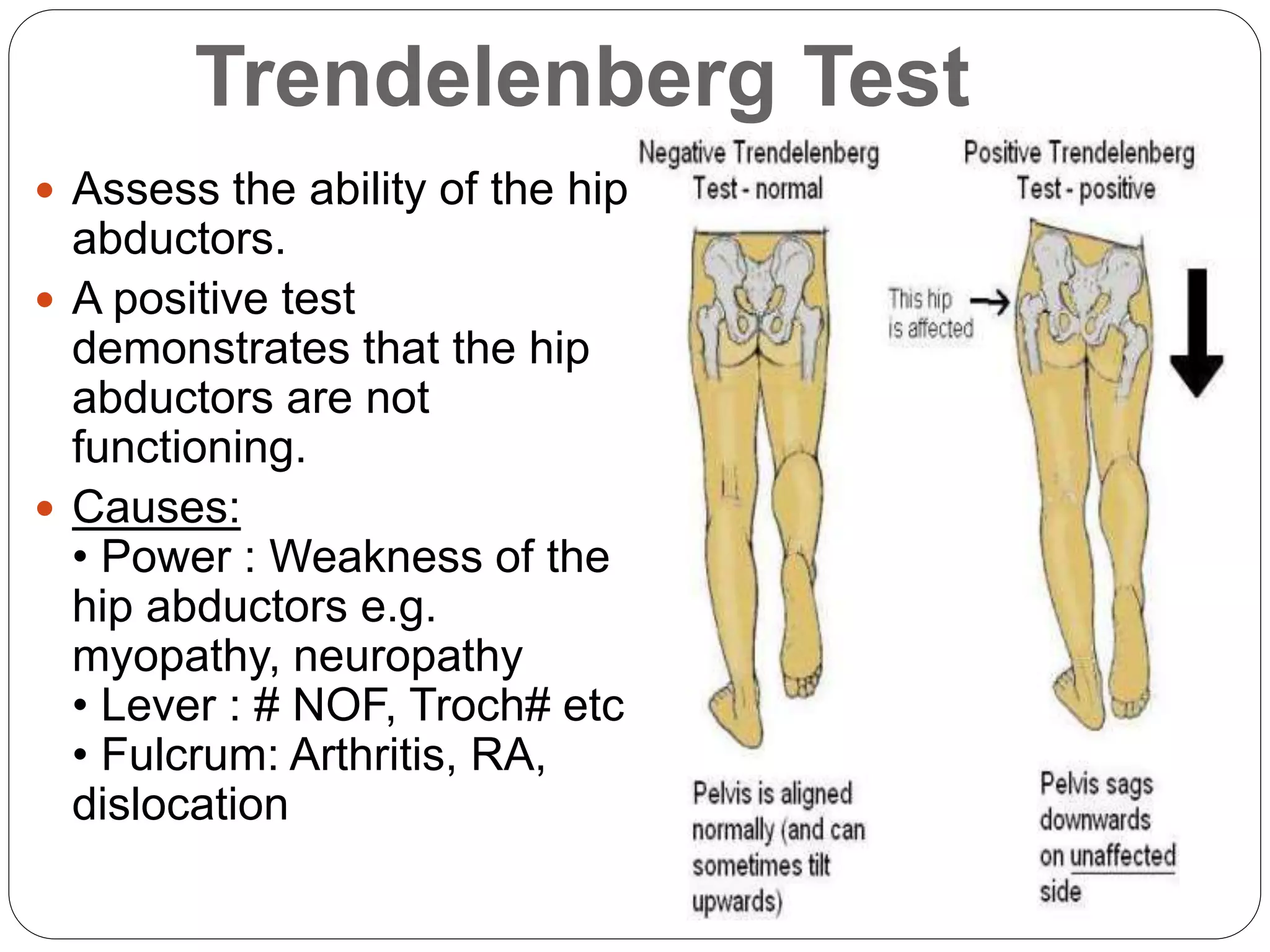 Assessment and special tests of Hip joint | PPTX