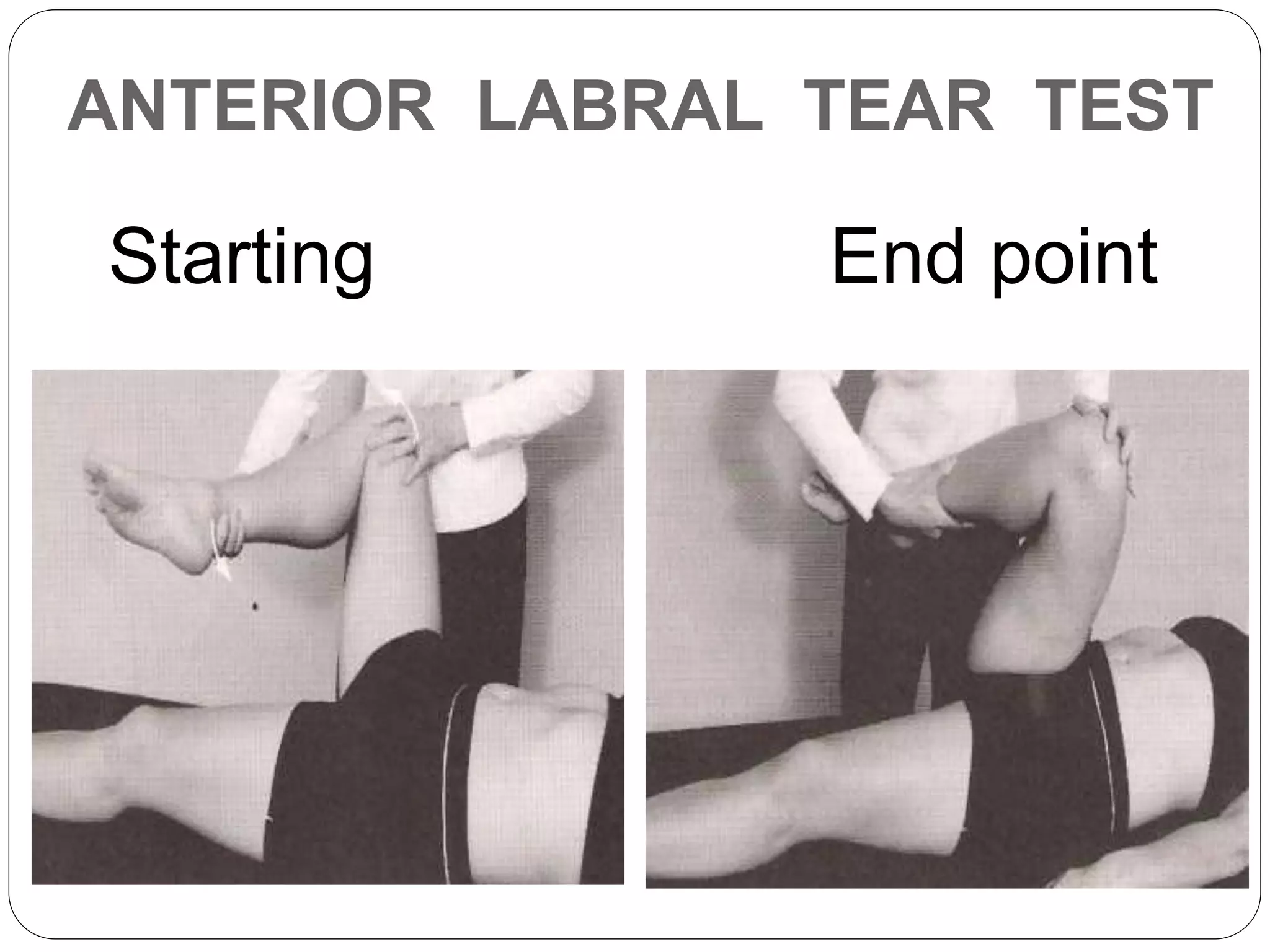 Assessment and special tests of Hip joint | PPTX