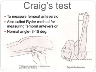 Assessment and special tests of Hip joint | PPTX