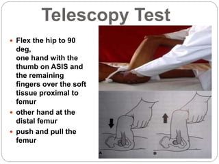 Assessment and special tests of Hip joint | PPTX