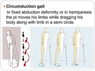 Circumduction Of Hip