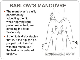 Assessment and special tests of Hip joint | PPT