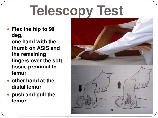 Assessment and special tests of Hip joint