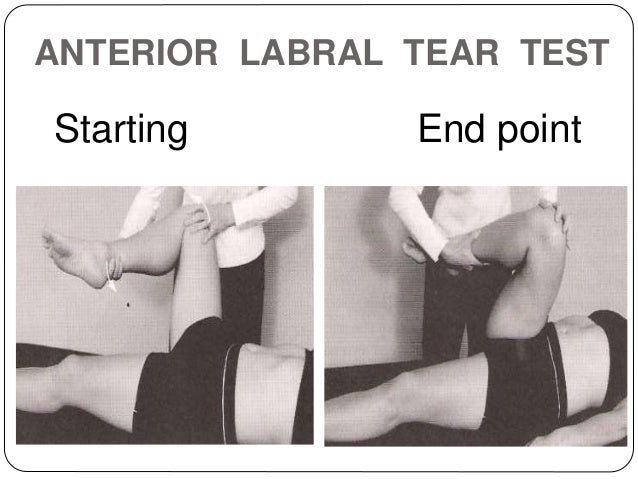 Assessment and special tests of Hip joint