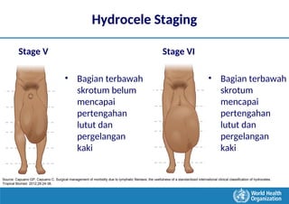 ASSESSMENT DAN KLASIFIKASI KASUS FILARIASIS - Copy.ppt