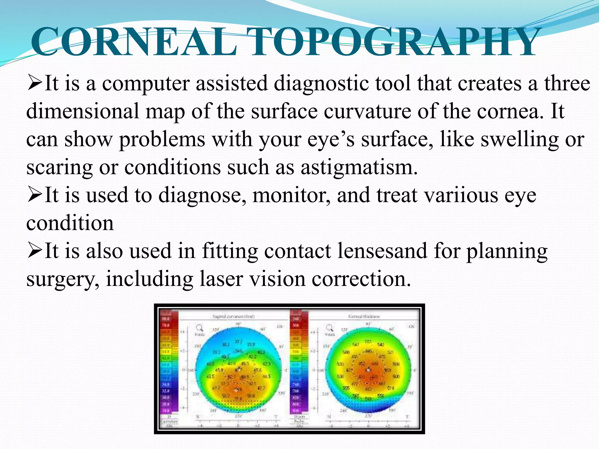 ASSESSMENT OF EYE | PPTX