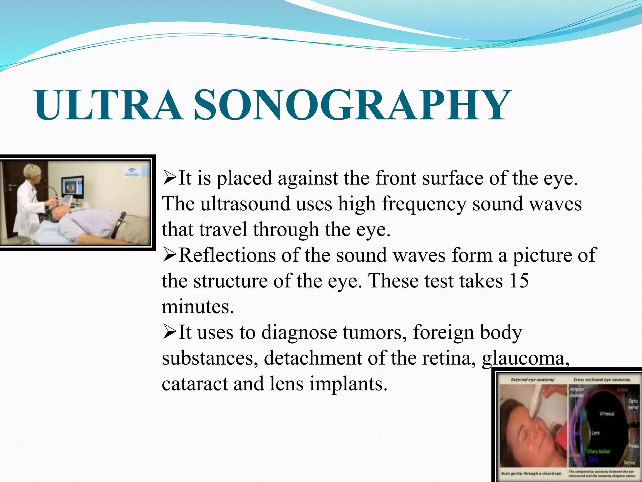 ASSESSMENT OF EYE | PPTX