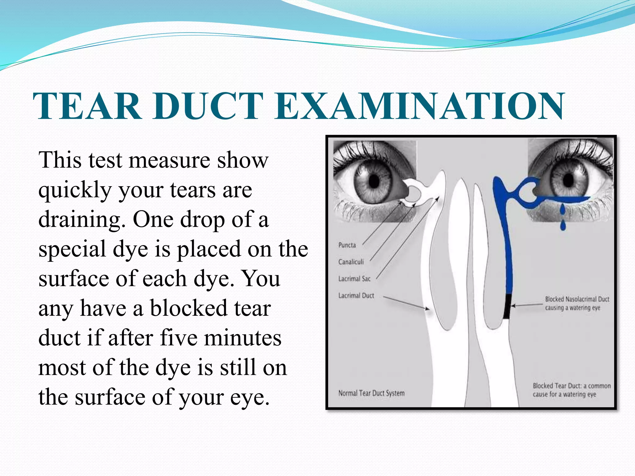 ASSESSMENT OF EYE | PPTX