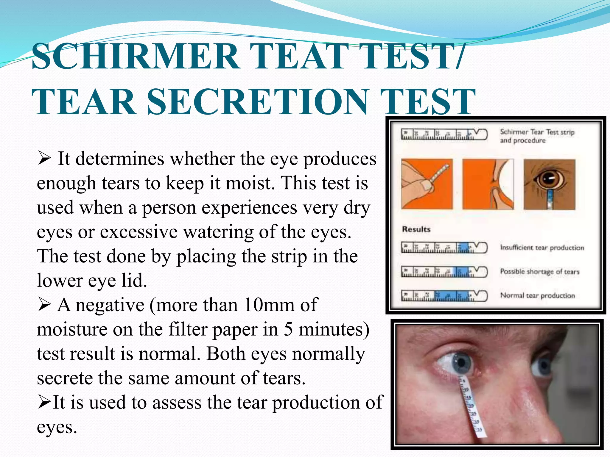 ASSESSMENT OF EYE | PPTX