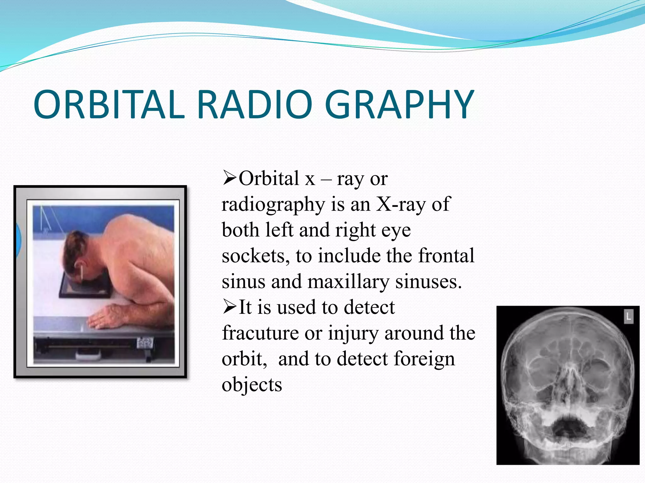 ASSESSMENT OF EYE | PPTX