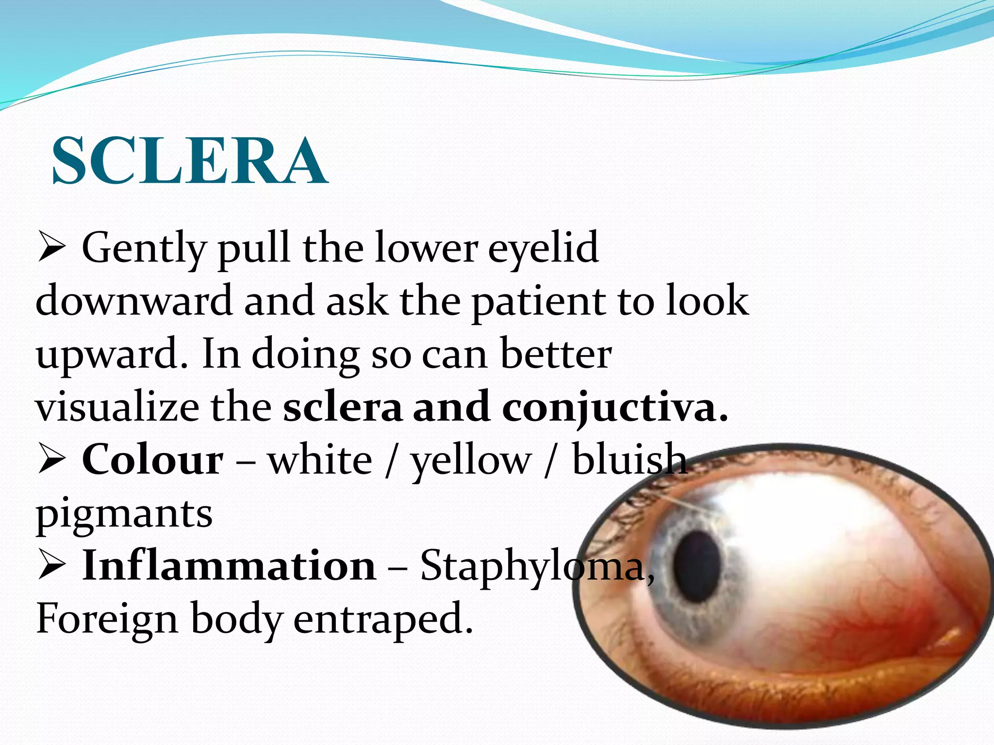ASSESSMENT OF EYE | PPTX