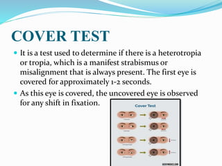 ASSESSMENT OF EYE | PPTX