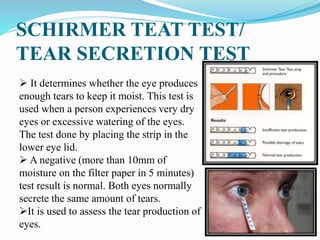 ASSESSMENT OF EYE | PPTX