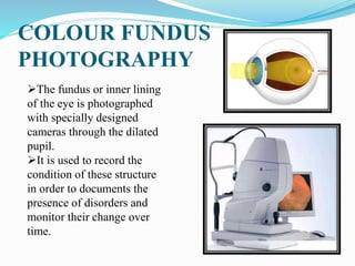 ASSESSMENT OF EYE | PPTX