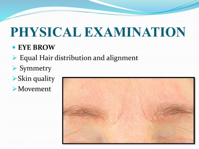 ASSESSMENT OF EYE | PPTX | Eye and Vision Conditions | Diseases and ...