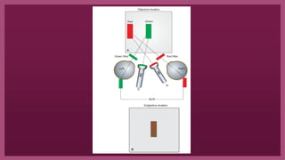 ASSESSMENT FOREXTRAOCULAR MUSCLE PARESIS (1).pptx