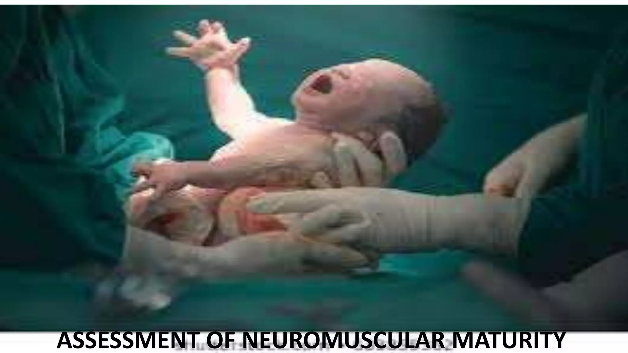 Assessment gestational age | PPTX