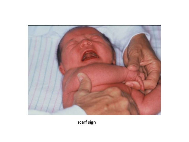 Assessment in Newborn