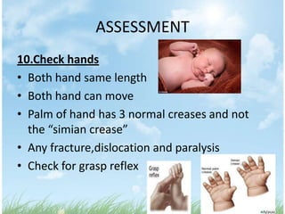Assessment newborn | PPTX
