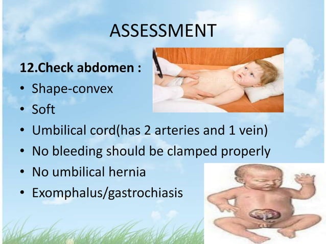 Assessment newborn | PPTX