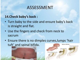 Assessment newborn | PPTX