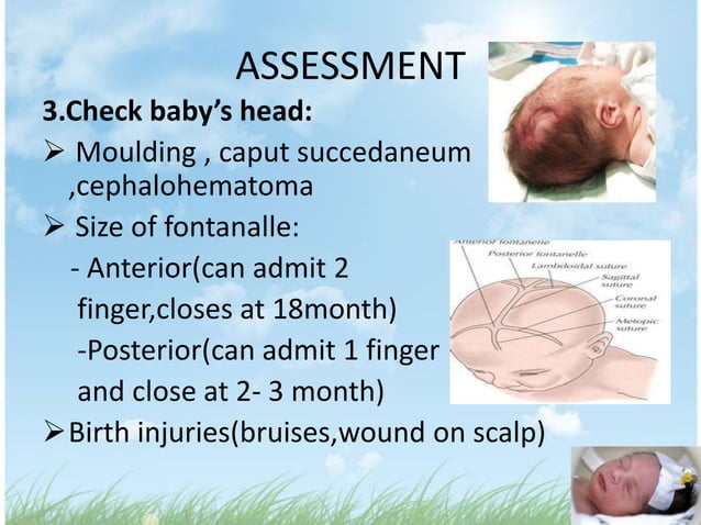 Assessment newborn | PPTX