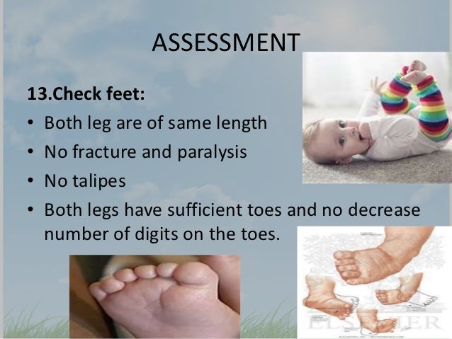 Assessment newborn