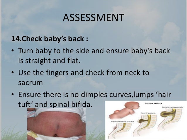 Assessment Newborn
