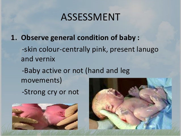 Assessment newborn