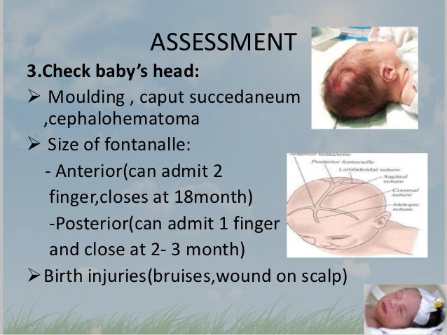 Assessment newborn