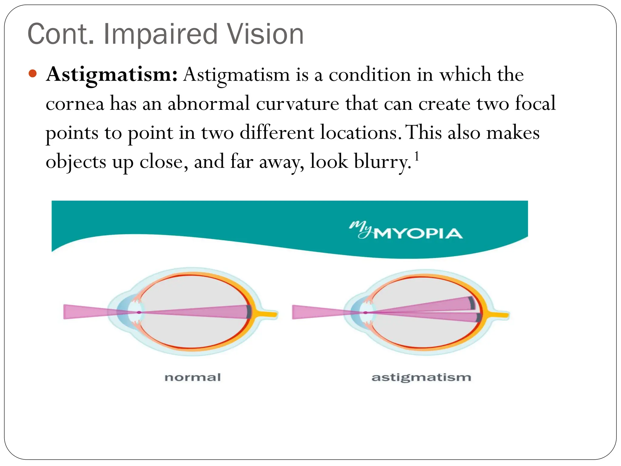assessment nursing eye.ppt2.ppt 222.pdf