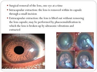 assessment nursing eye.ppt2.ppt 222.pdf