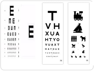 assessment nursing eye.ppt2.ppt 222.pdf