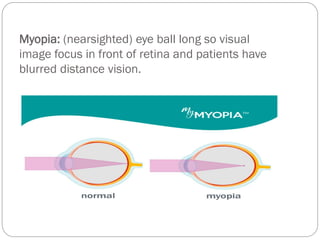assessment nursing eye.ppt2.ppt 222.pdf